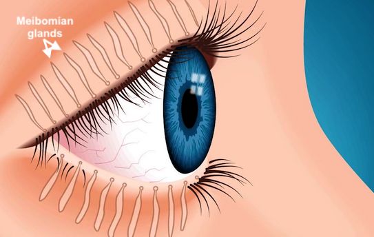 Angular Blepharitis