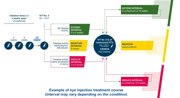 Eye Injection I Mr Ellabban | Experienced Retina Specialist